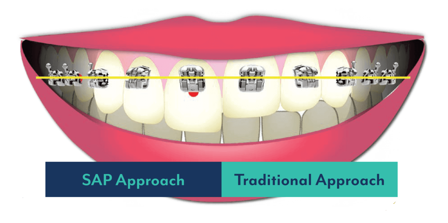 Everything You Need To Know About Smile Arc Protection - Smile Patio